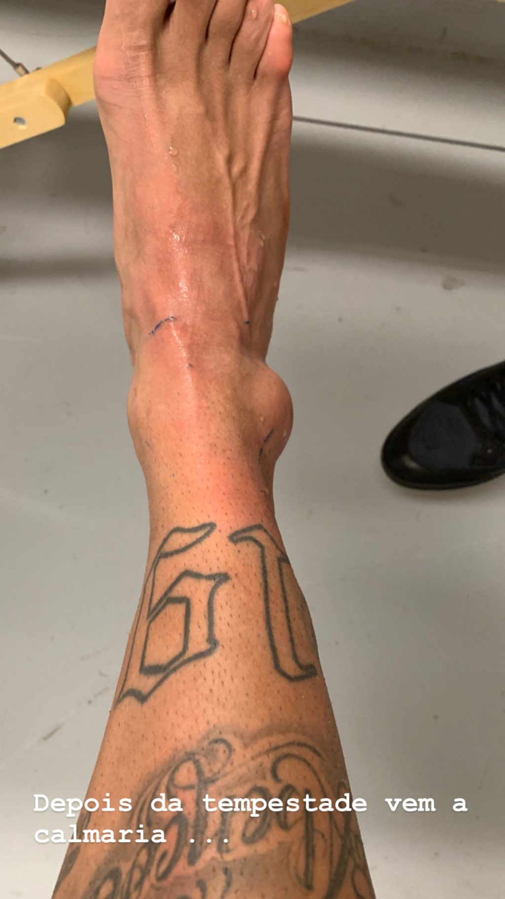 Neymar posta foto do pé machucado após corte da Copa América: ‘Depois ... Neymar posta foto do pé machucado após corte da Copa América: ‘Depois ...