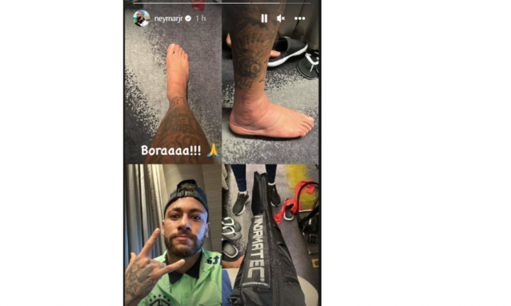 Com pé inchado, Neymar mostra tratamento para se recuperar de lesão ...